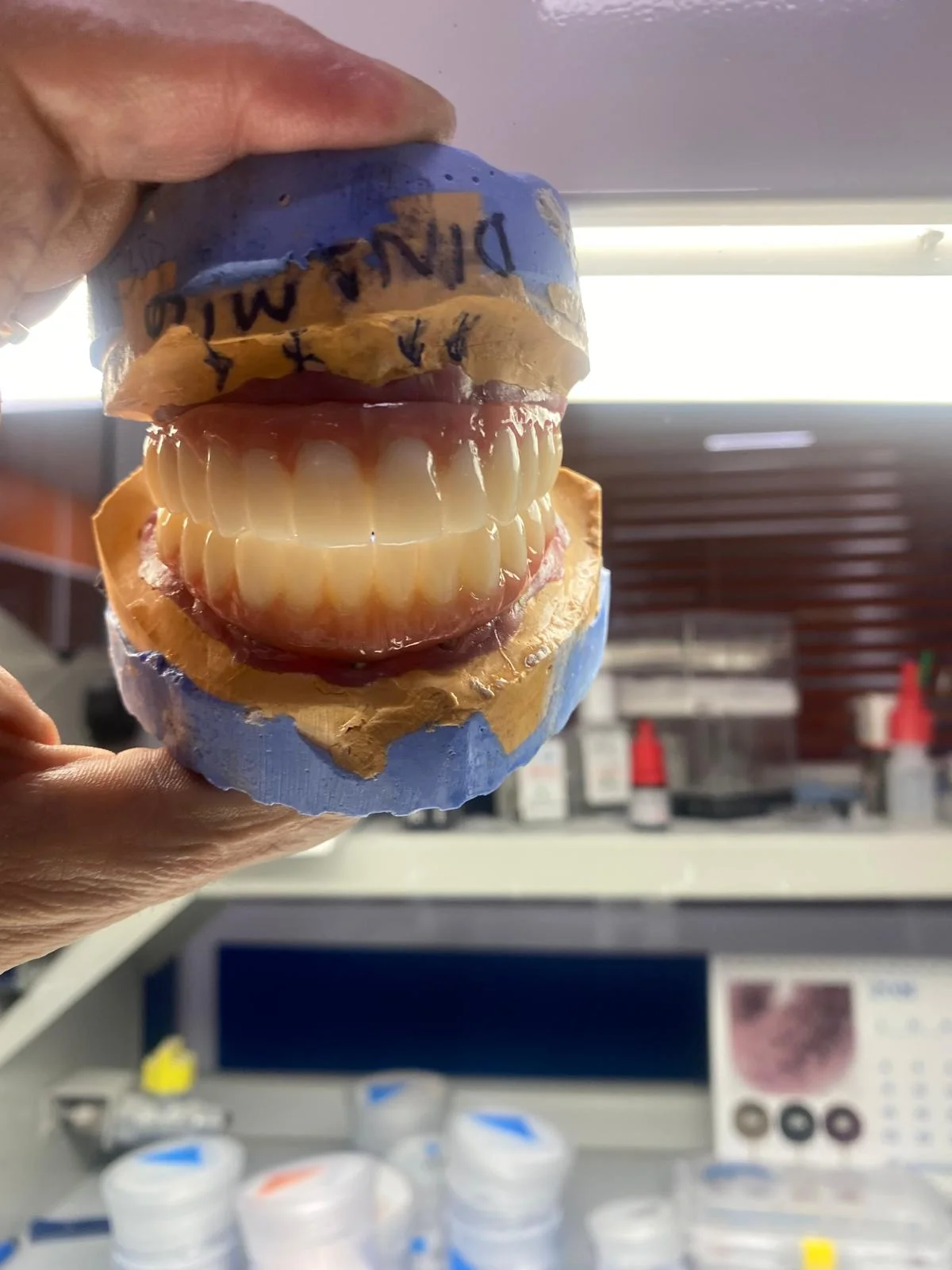 Prótesis Dentales - Aldo Dental